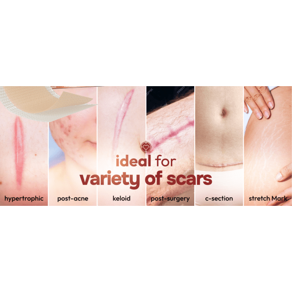 MorningSave: 2-Pack: AllSett Health Silicone Scar Tape