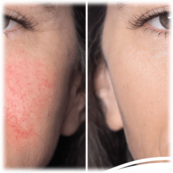 MorningSave: Predire Paris 8-Element Pro Cordless Multi-Purpose LED Mask