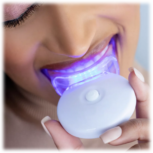 MorningSave: SpaDent Naturals Light Activated Professional Teeth ...