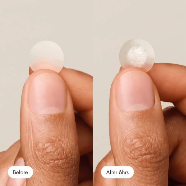 MorningSave: 216-Pack: Mighty Patch Acne and Pimple Patches