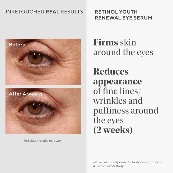 MorningSave: Murad Retinol Youth Renewal Eye Serum (0.5 oz)